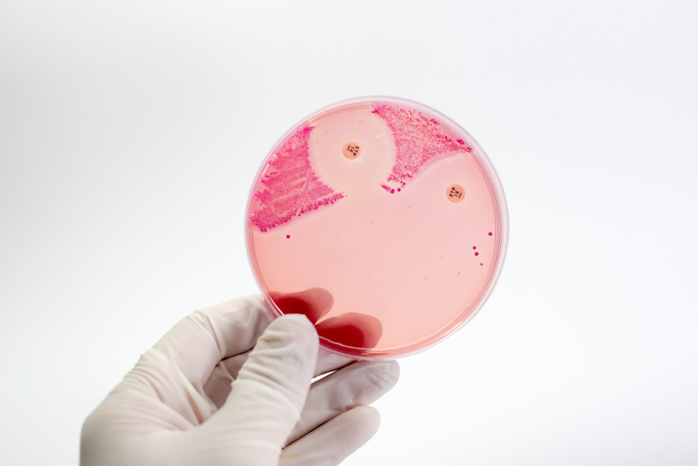 Antimicrobial resistance research: learning lessons from the COVID-19 ...